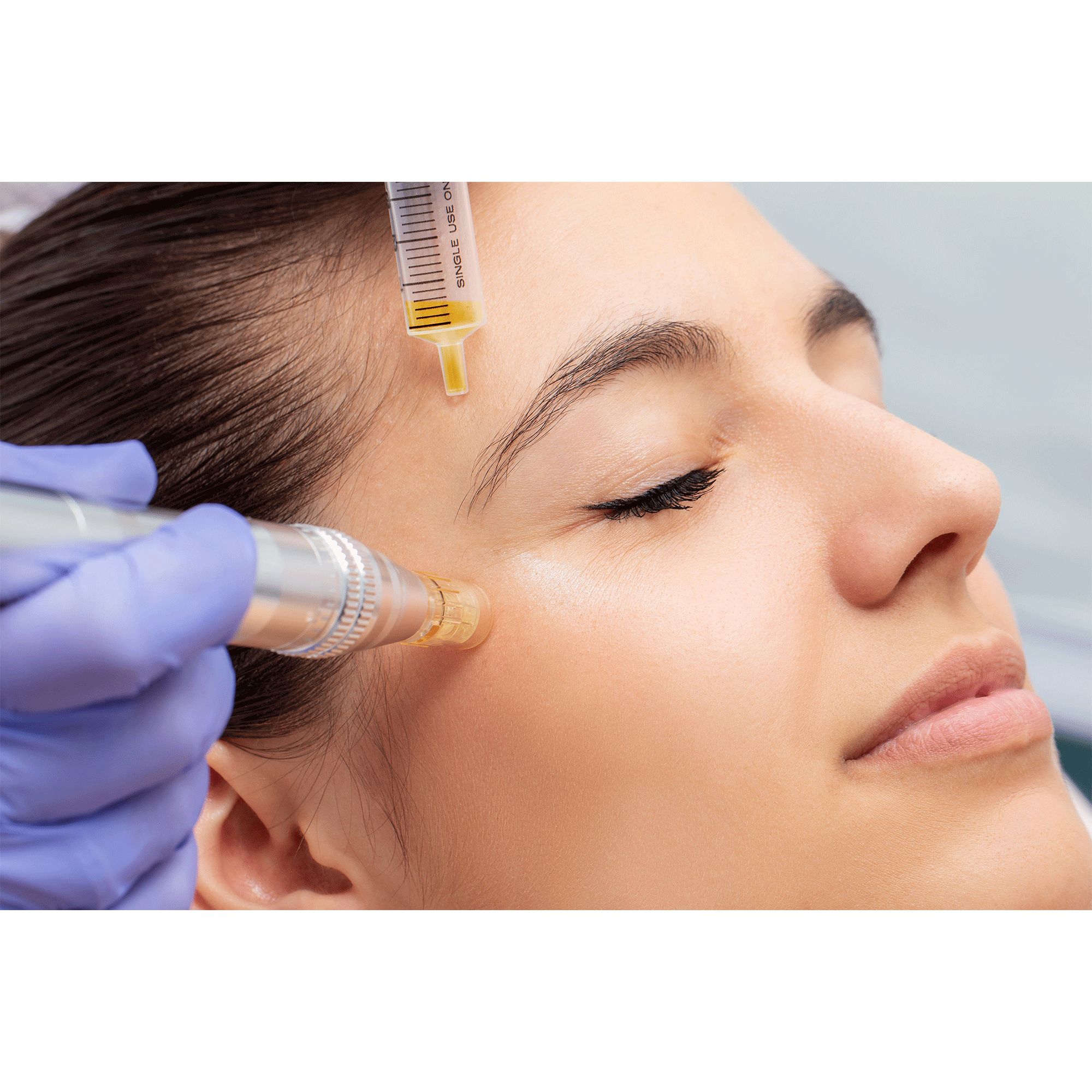 PRP for Under Eye Treatments - Colair Beauty Lounge & Med Spa