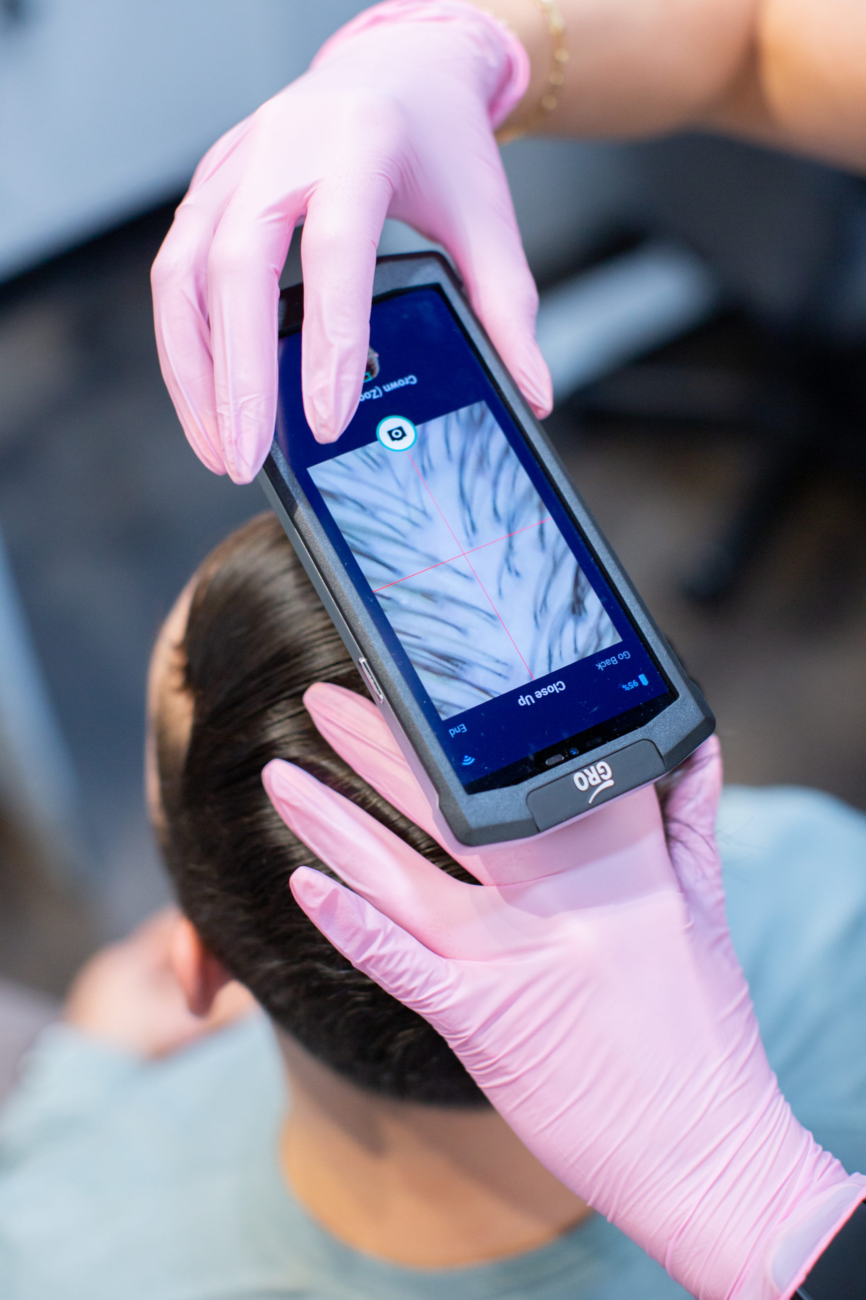 GroTrack Hair Growth Monitoring | Colair Med Spa in Gilbert