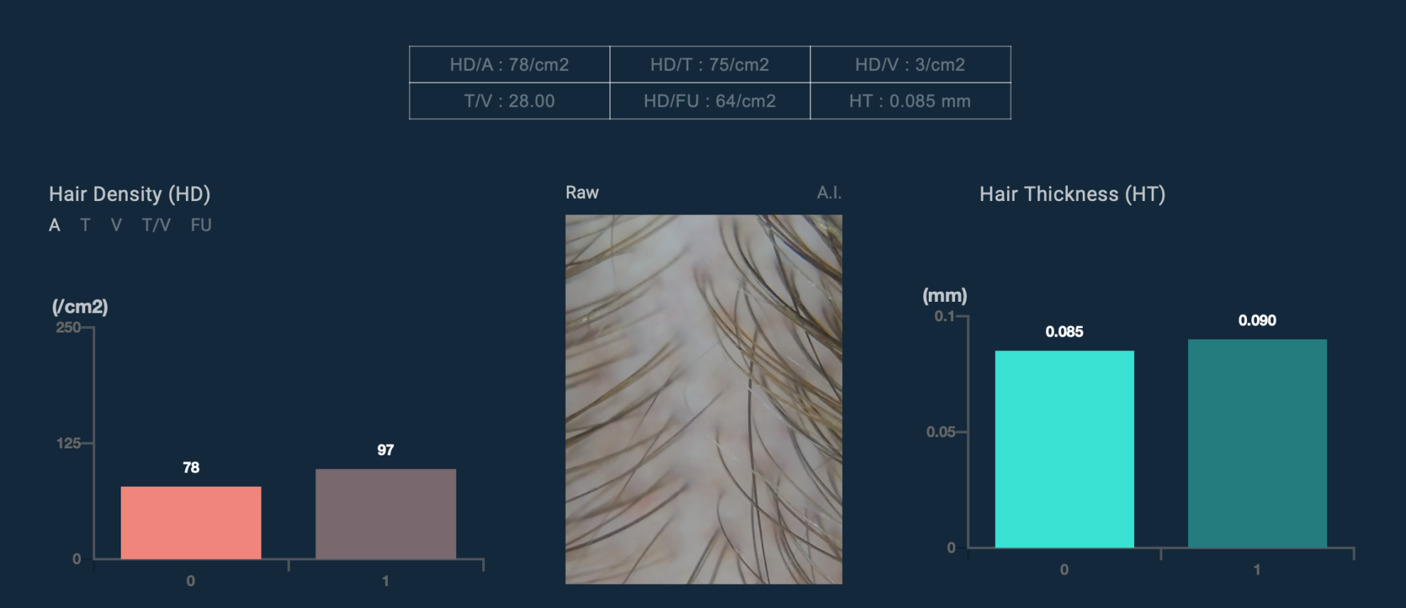 GroTrack Hair Growth Monitoring | Colair Med Spa in Gilbert