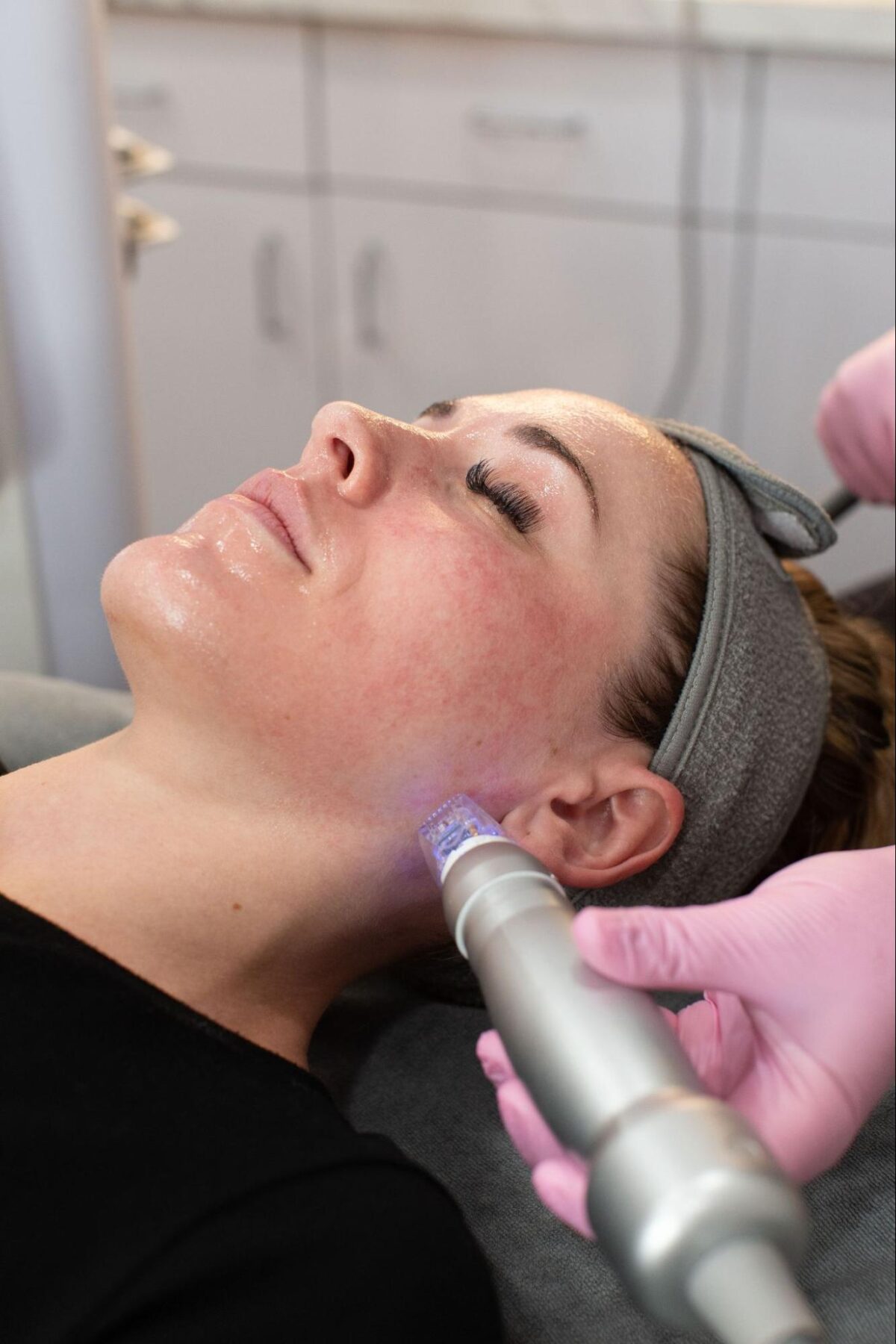 Scarlet RF Microneedling vs. Traditional Microneedling - Colair