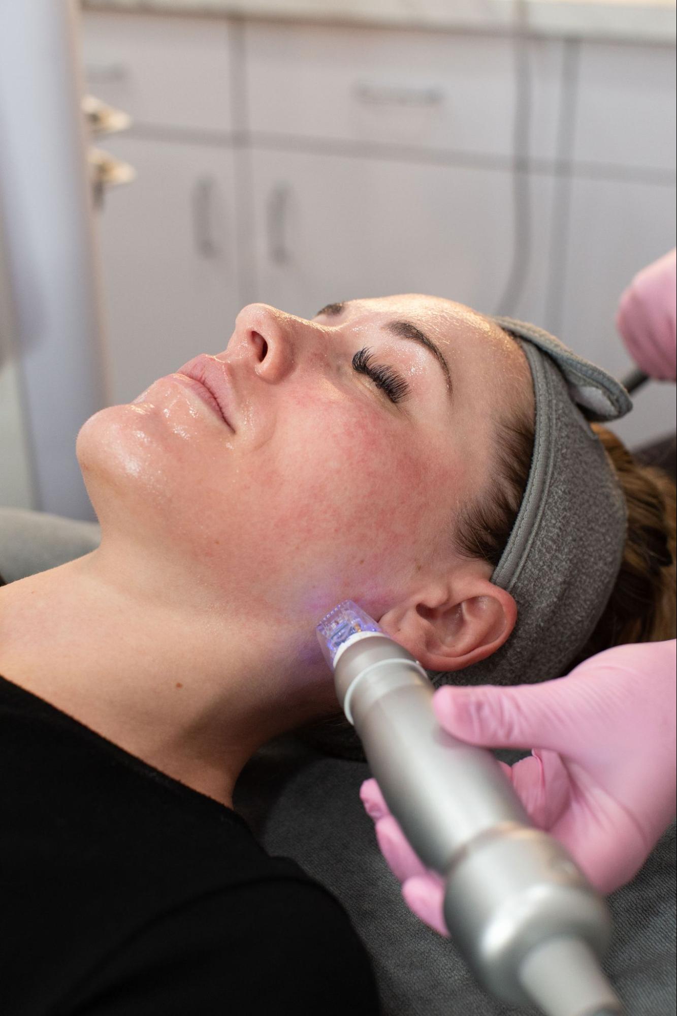 Scarlet RF Microneedling vs. Traditional Microneedling - Colair