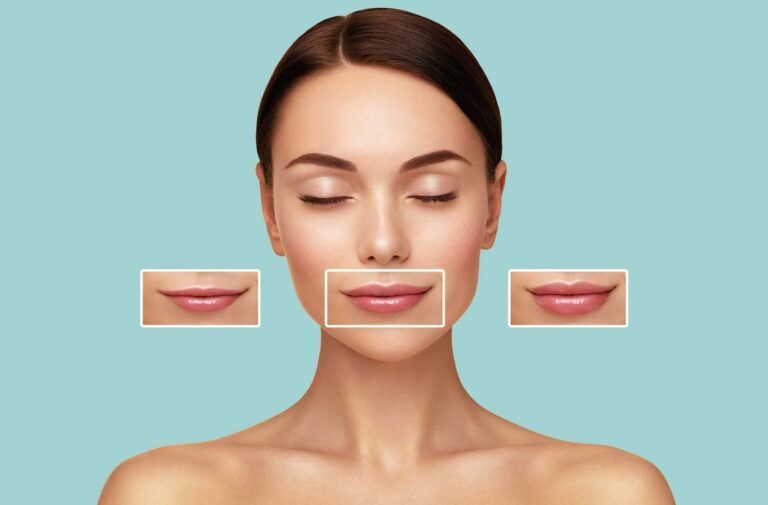 Lip Injection Shapes for Your Face: Which Filler Techniques Flatter You?